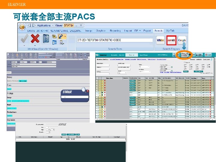STATdx Diagnostic Decision Support for Radiology Jessie Qian