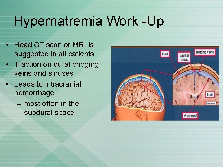Hypernatremia and Fluid Resuscitation Staci Smith DO Hypernatremia