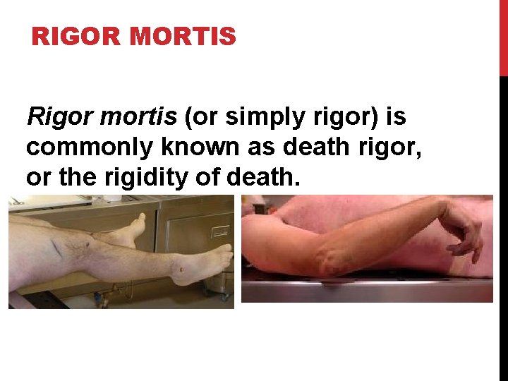 POST MORTEM CHANGES DEATH INVESTIGATION The Coroner System
