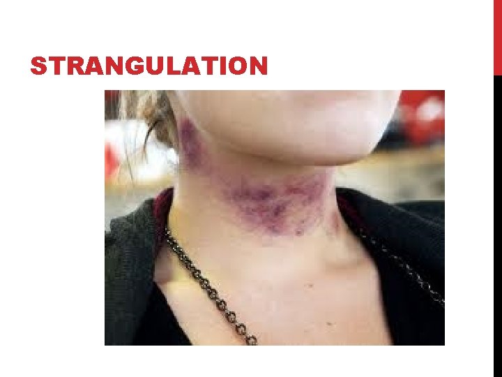 POST MORTEM CHANGES DEATH INVESTIGATION The Coroner System