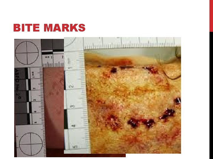 POST MORTEM CHANGES DEATH INVESTIGATION The Coroner System