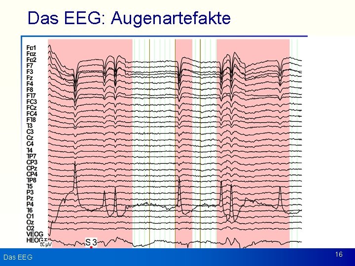 Methoden der biologischen Psychologie Das EEG Birbaumer und