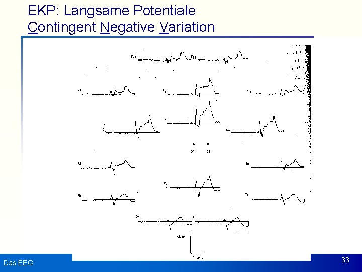 Methoden der biologischen Psychologie Das EEG Birbaumer und