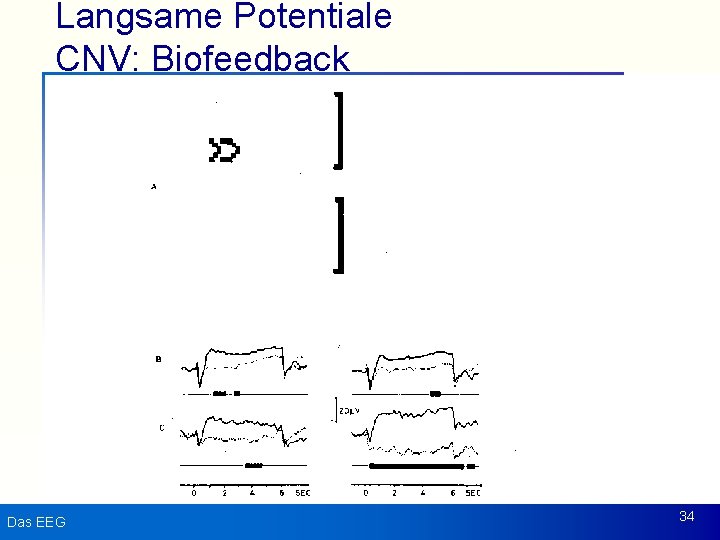 Methoden der biologischen Psychologie Das EEG Birbaumer und