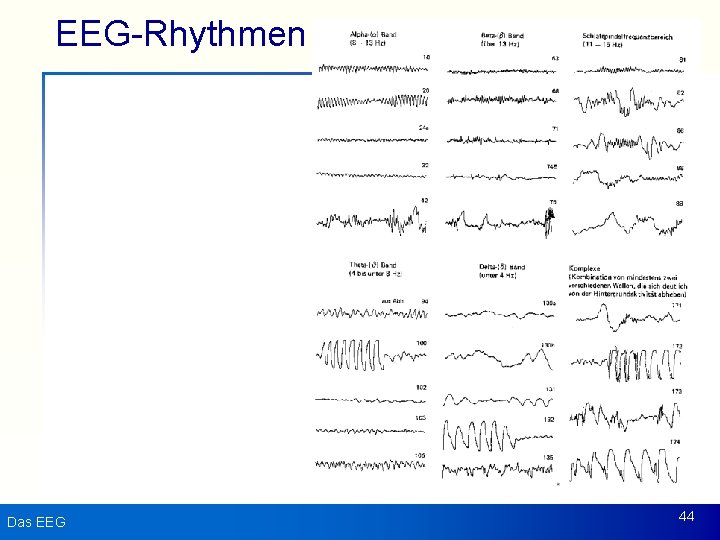 Entstehung Des Eeg Signals – Eeg Aufzeichnung – WATQVT