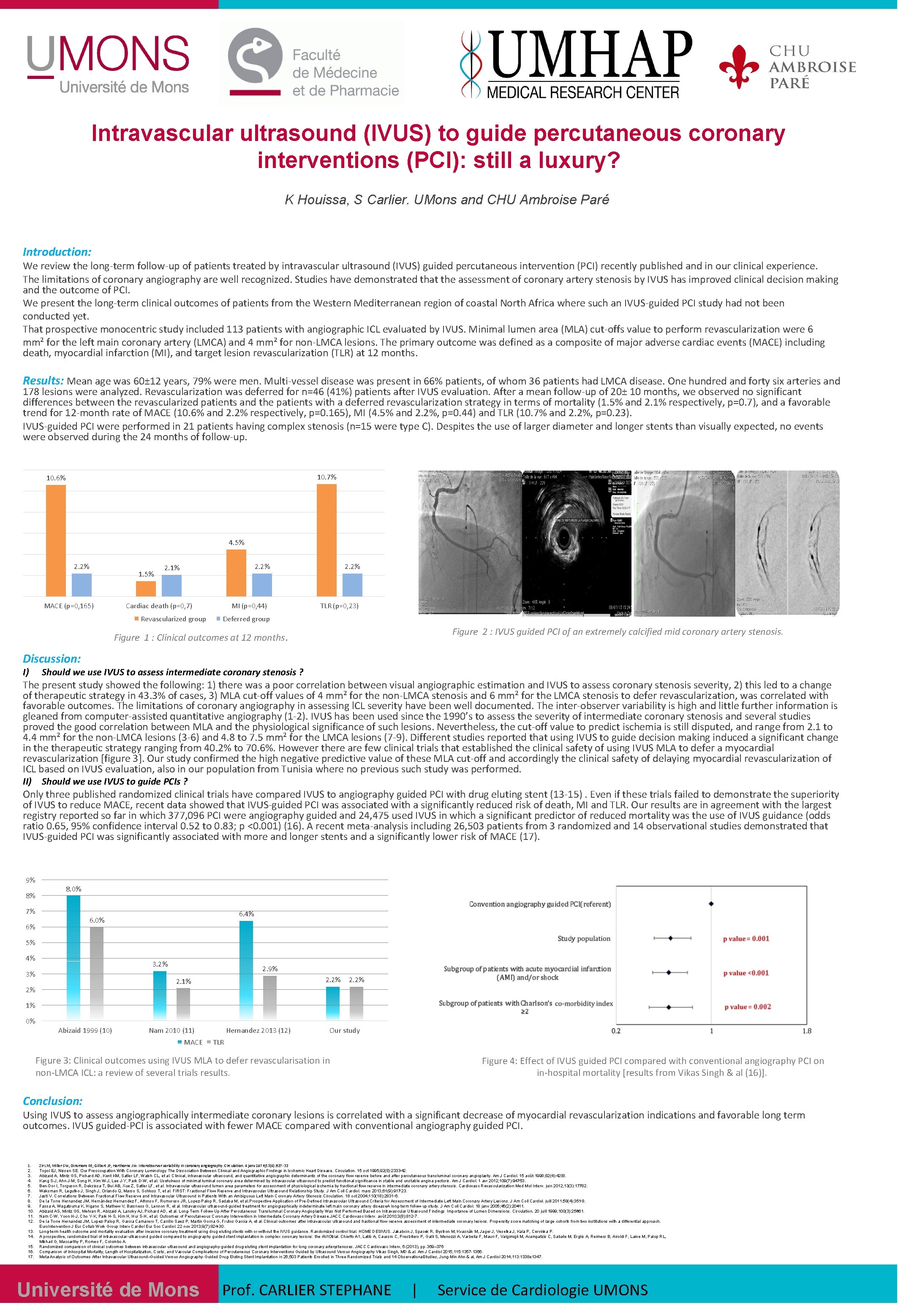 Intravascular ultrasound IVUS to guide percutaneous coronary interventions
