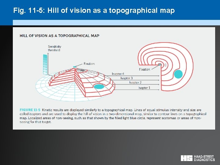 Visual Field Digest Teaching Kit Chapter 11 HAAGSTREIT