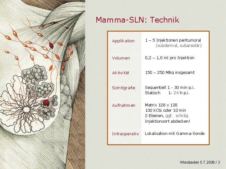 SLN WchterLymphknoten beim Mammakarzinom Der sentinel lymph node