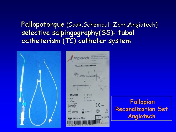 SELECTIVE HYSTEROSALPINGOGRAPHY AND TUBAL RECANALIZATION WHEN TO DO