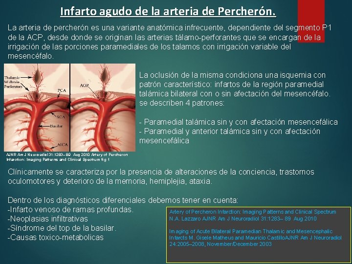 CASO CLNICO DE ICTUS AGUDO Paciente mujer de
