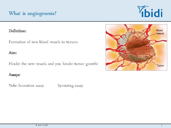 Integrated Bio Diagnostics Product information Slide Angiogenesis ibidi