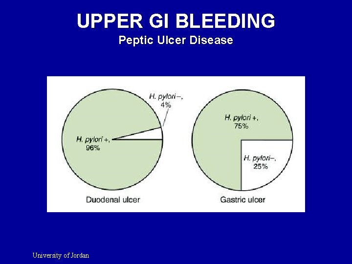 Upper GI bleeding University of Jordan UPPER GI