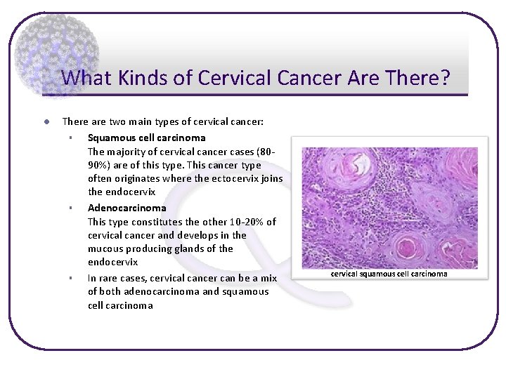 Cervical Cancer What is Cancer l l l