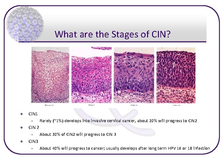 Cervical Cancer What is Cancer l l l