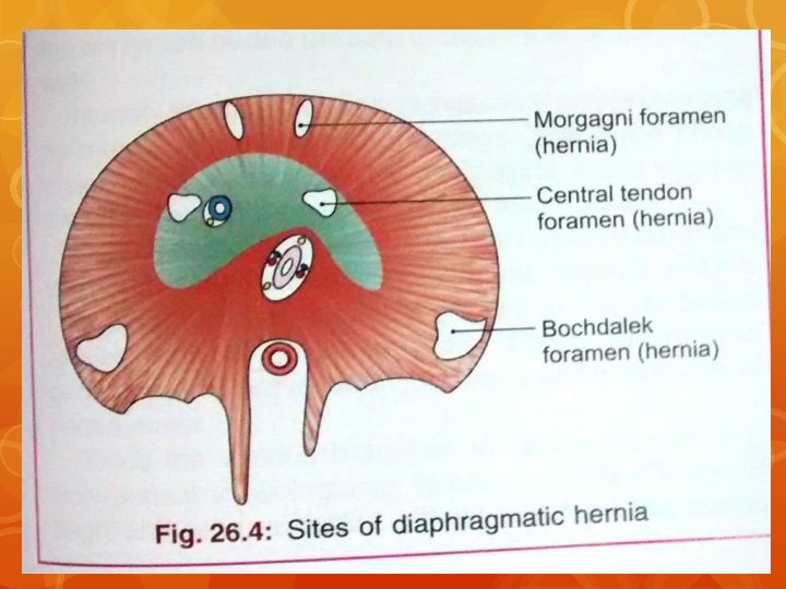 ANATOMY OF Diaphragm BY Dr Manjula vastrad asst
