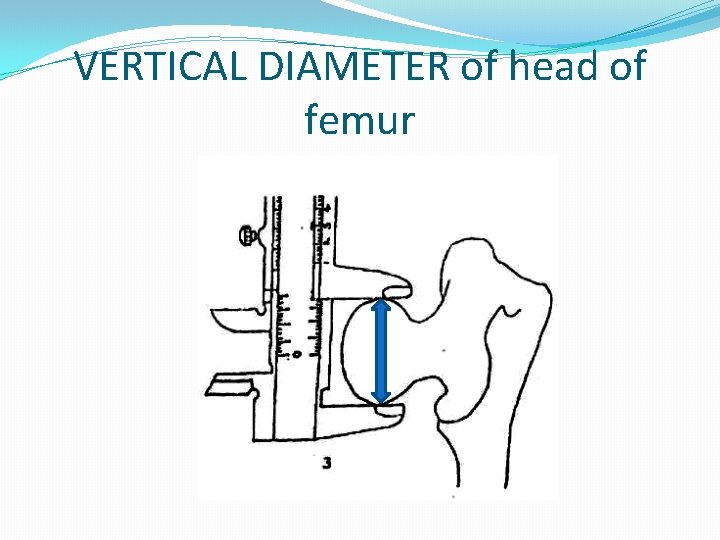 Examination of skeletal remains lower limbs By Dr