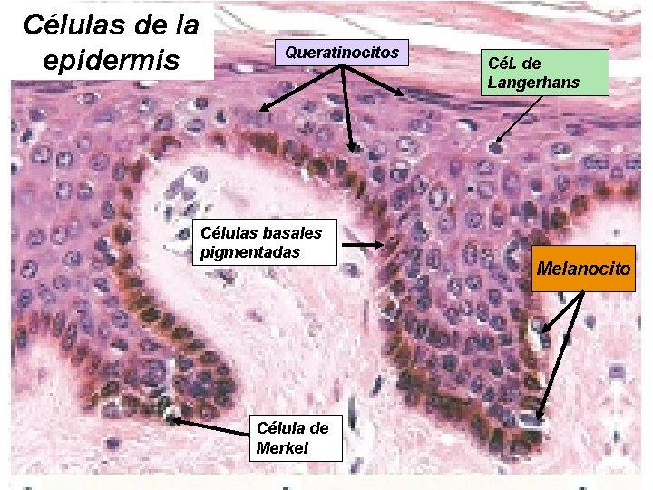 HISTOLOGA DE LA PIEL Dra Elena Morales Casasola