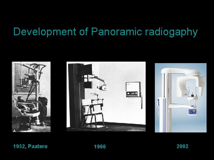 Panoramic radiography Development of Panoramic radiogaphy 1952 Paatero