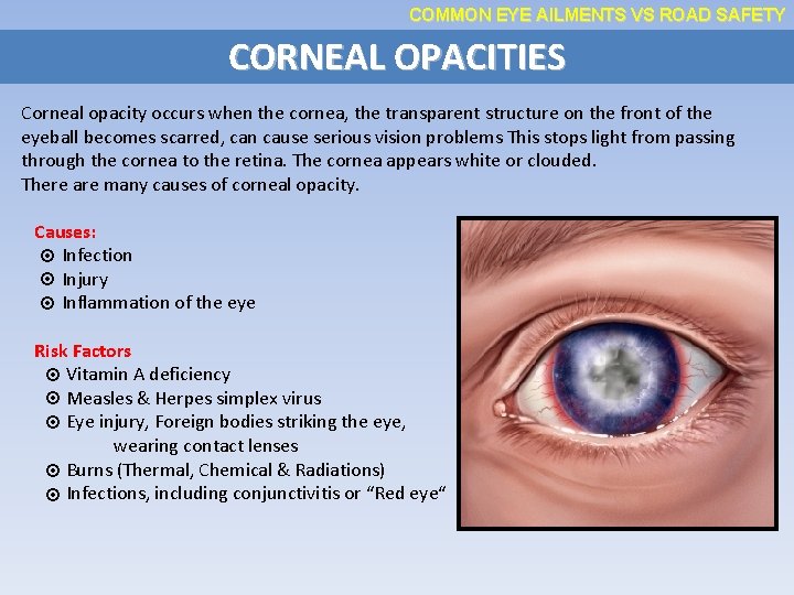 Common Eye Ailments Threat to Road Safety DR
