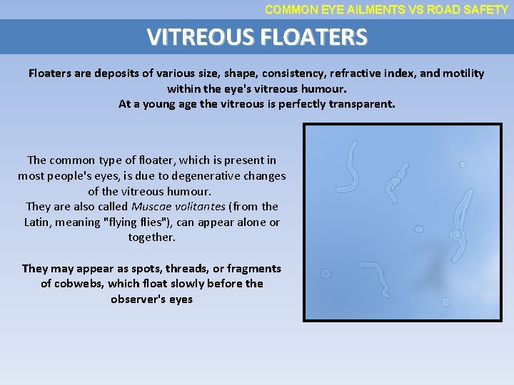 Common Eye Ailments Threat to Road Safety DR