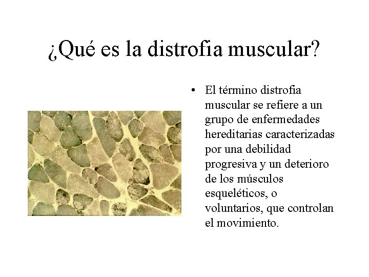DISTROFIA MUSCULAR Qu es la distrofia muscular El