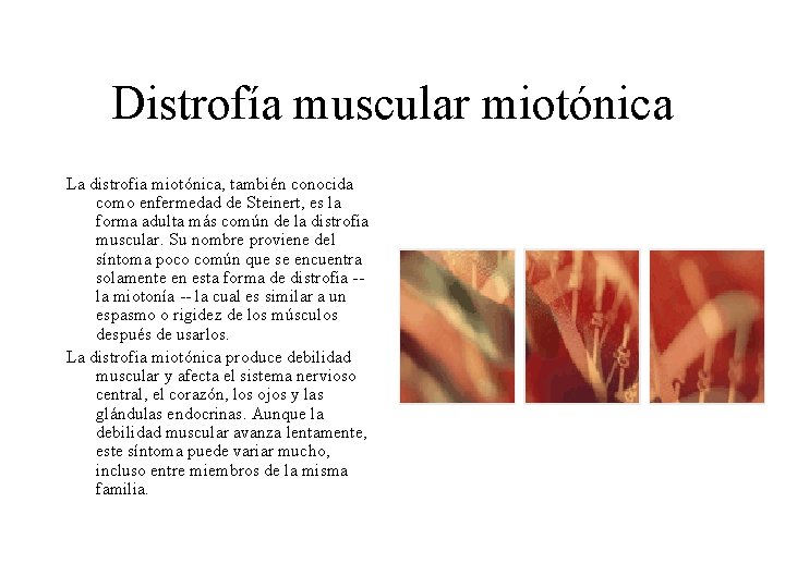 DISTROFIA MUSCULAR Qu es la distrofia muscular El