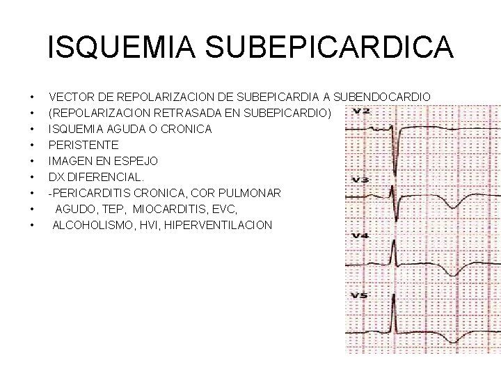 ISQUEMIA LESION Y NECROSIS CAMBIOS EKG ISQUEMIA ONDA
