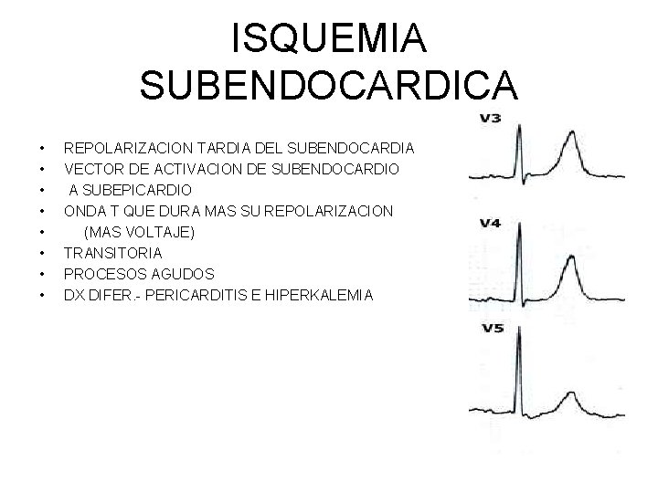 ISQUEMIA LESION Y NECROSIS CAMBIOS EKG ISQUEMIA ONDA