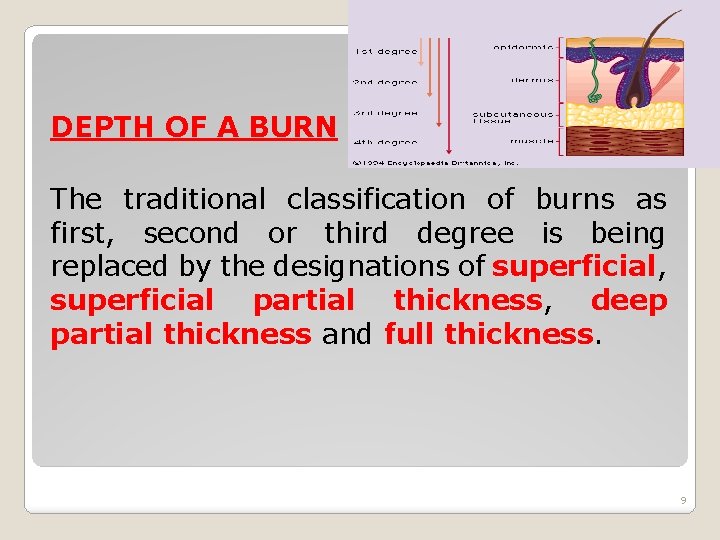 Management of Minor Burns and Sunburn Pharmacist Role