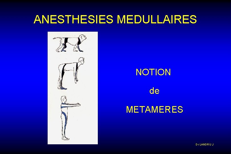 ANESTHESIE LOCOREGIONALE Dr LANDRU J Anesthsie slective dune