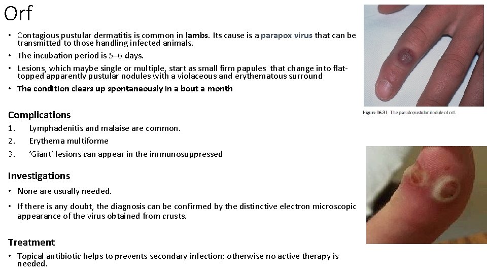 Viral Skin Infections Presented by Laith Sorour Herpes