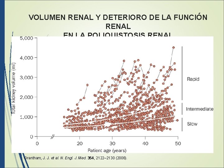 Poliquistosis Renal Autosmica Dominante Anlisis De Los Factores