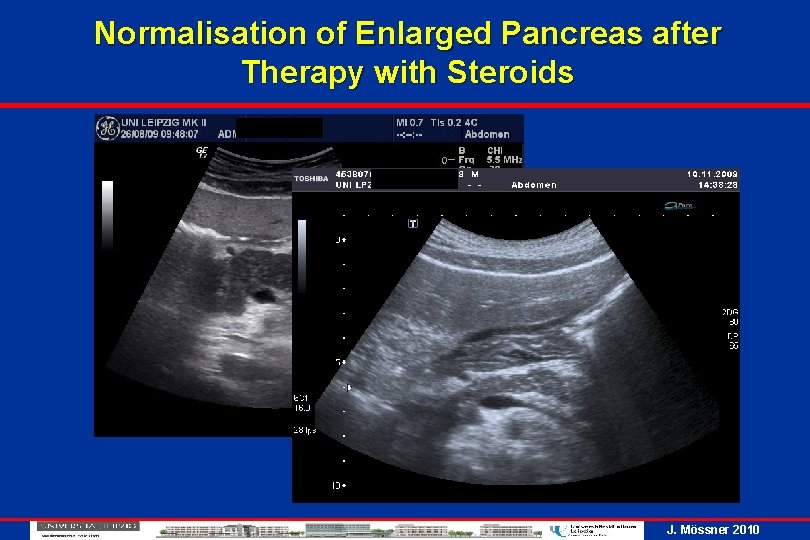 Patient with Relapsing Pancreatitis and Cholestasis Klinik und
