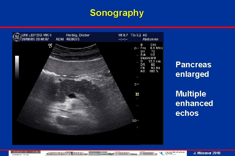 Patient with Relapsing Pancreatitis and Cholestasis Klinik und