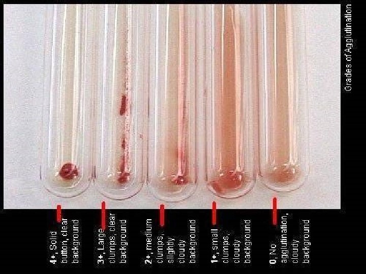 Practical Blood Bank Antibody Titration Principle Titration is