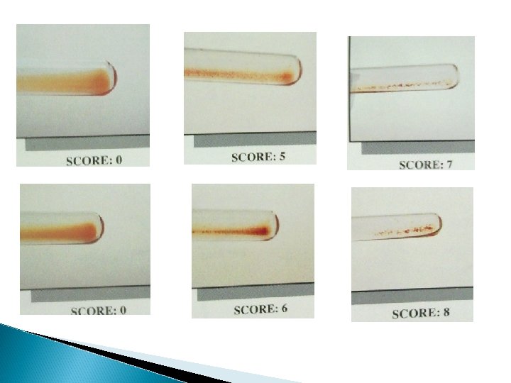 Practical Blood Bank Antibody Titration Principle Titration is