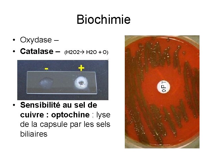 Infections Respiratoires Infections communautaires S Pneumoniae ...