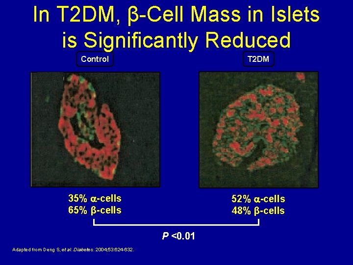 In T 2 DM Cell Mass in Islets