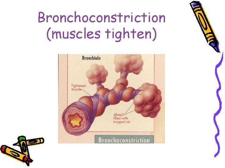 Asthma 101 Living with Asthma Your NameCredentials Job