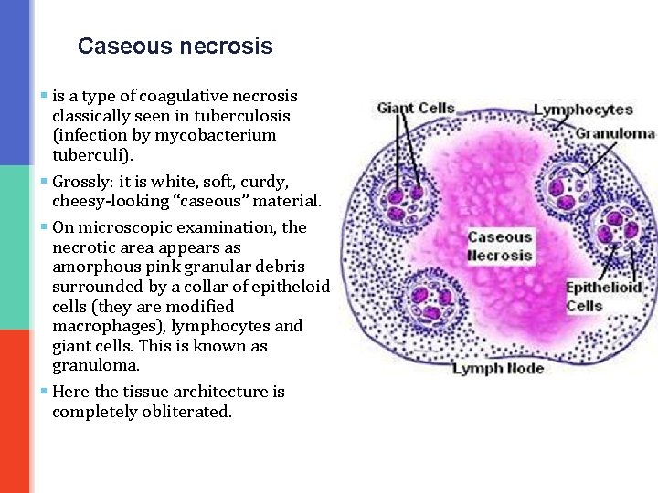 PATHOLOGY Chapter CELL INJURY for first year medical