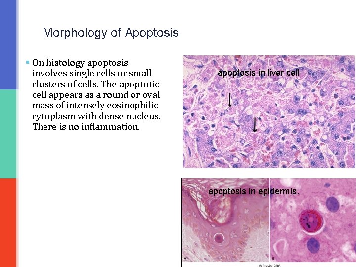 PATHOLOGY Chapter CELL INJURY for first year medical