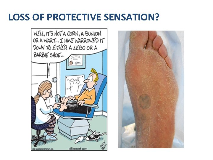 DIABETES AND FEET Everything you need to know