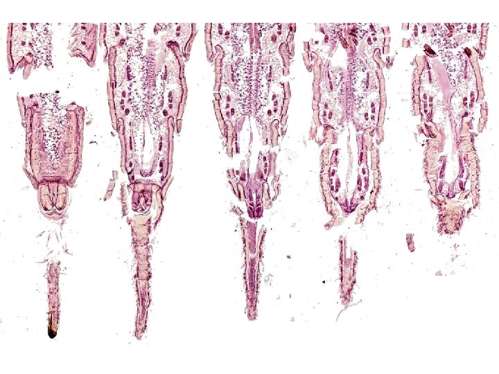 About homology of Haliplus Latreille 1802 larvae postanal