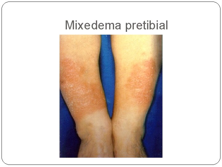 Semiologa sistema endocrino Dr Mario Ponchner Lechtman Servicio