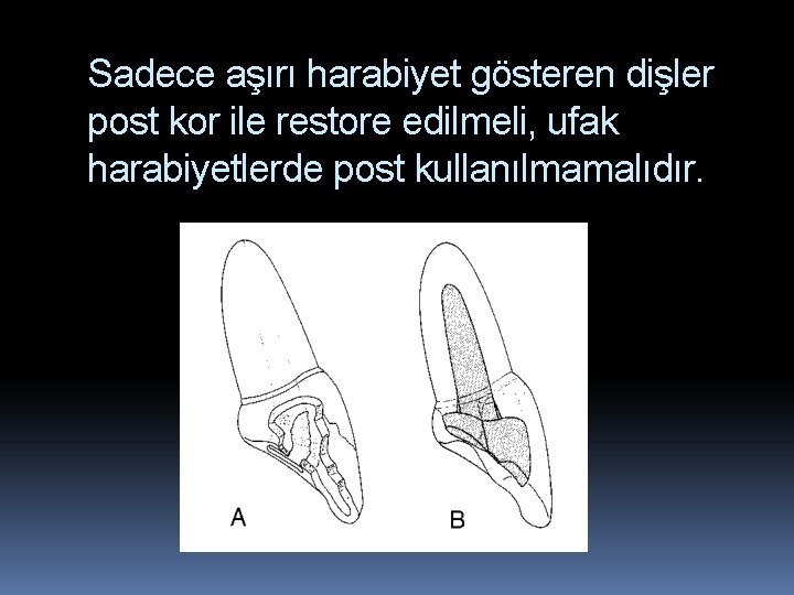 Endodontik Olarak Tedavi Edilmi Dilerin Protetik Tedavisi Prof