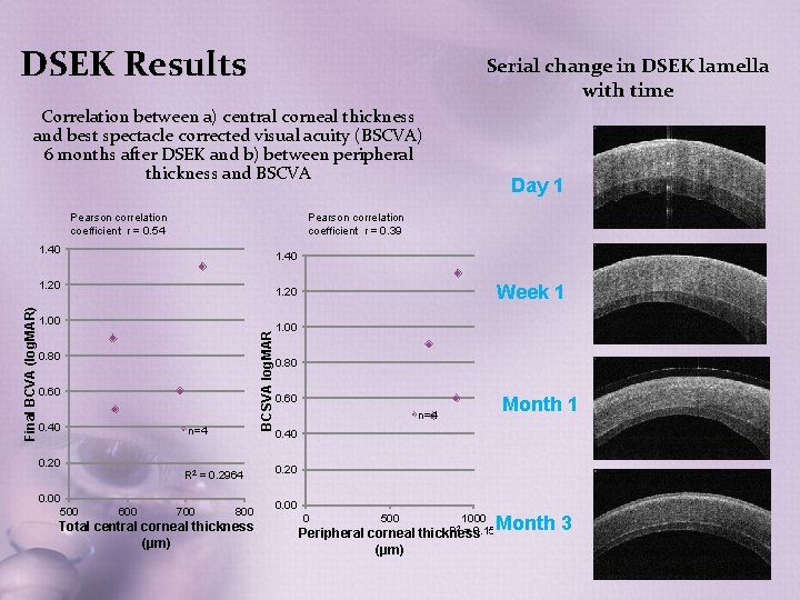 Evaluation of Corneal Graft Profile Following Deep Anterior
