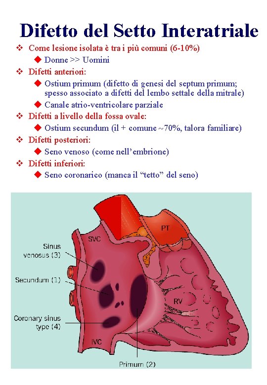 Difetto del Setto Interatriale v Come lesione isolata