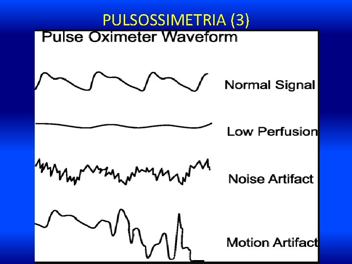 IL MONITORAGGIO DEL MALATO RESPIRATORIO Dr Francesco Fabiano
