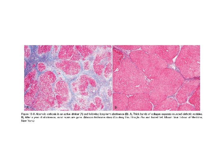 Liver diseases I and II The liver is