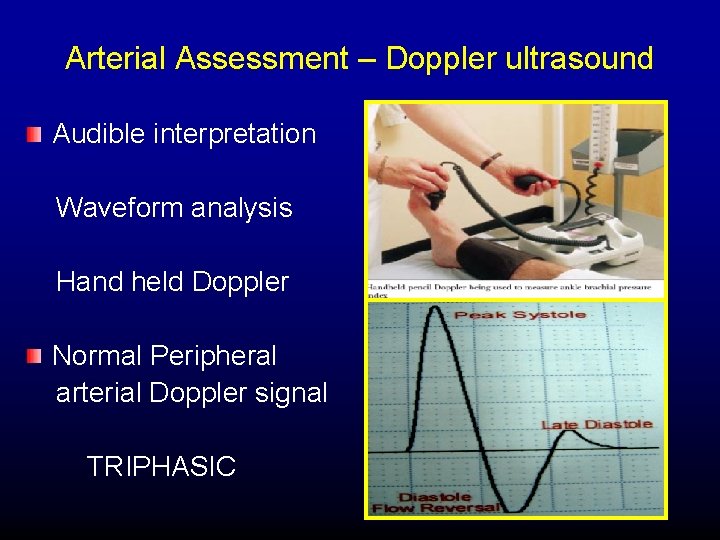 Vascular Investigations KKUH King Saud University Riyadh Non